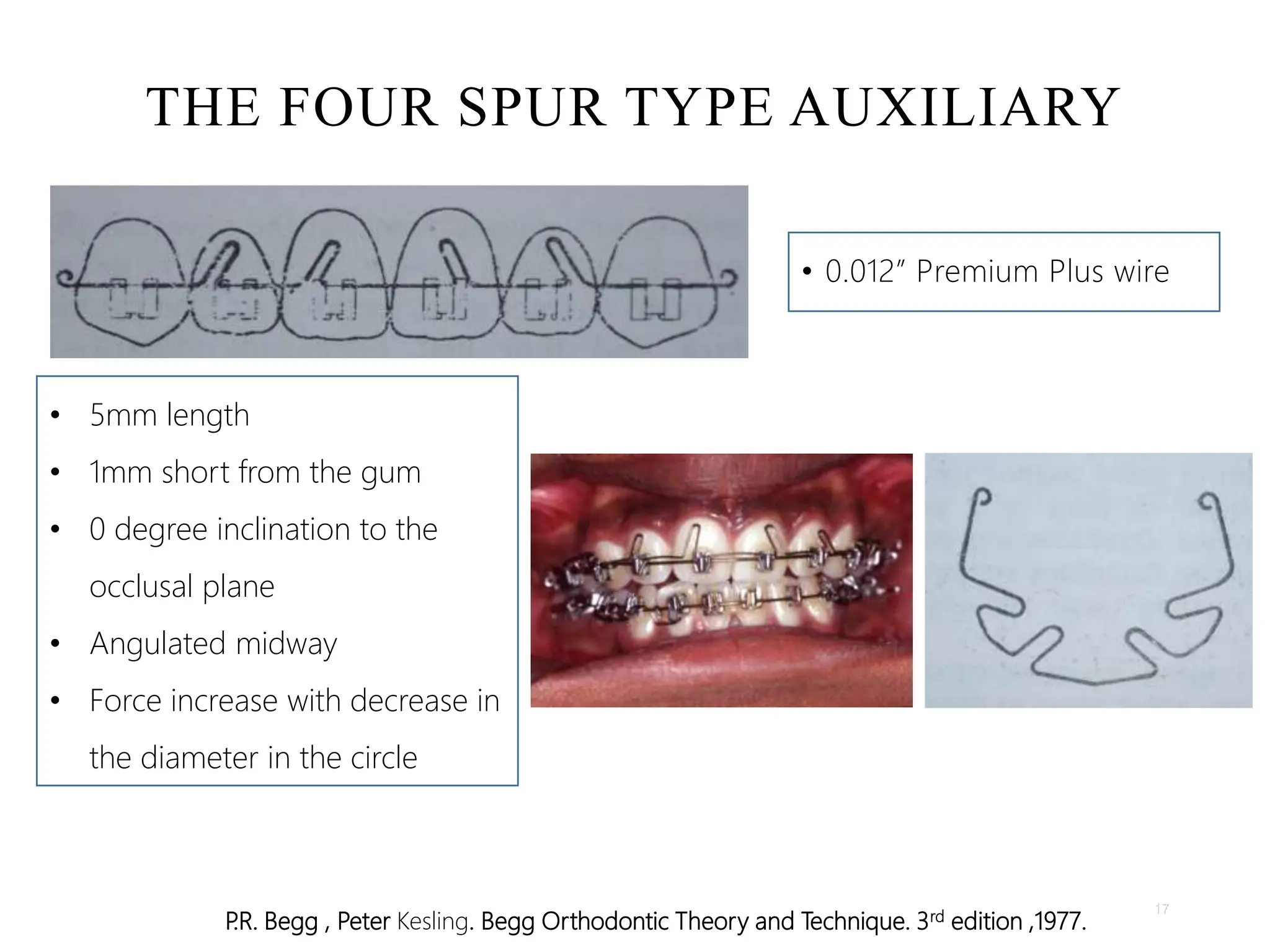 TORQUE IN ORTHODONTICS (short PPT) basic | PPTX