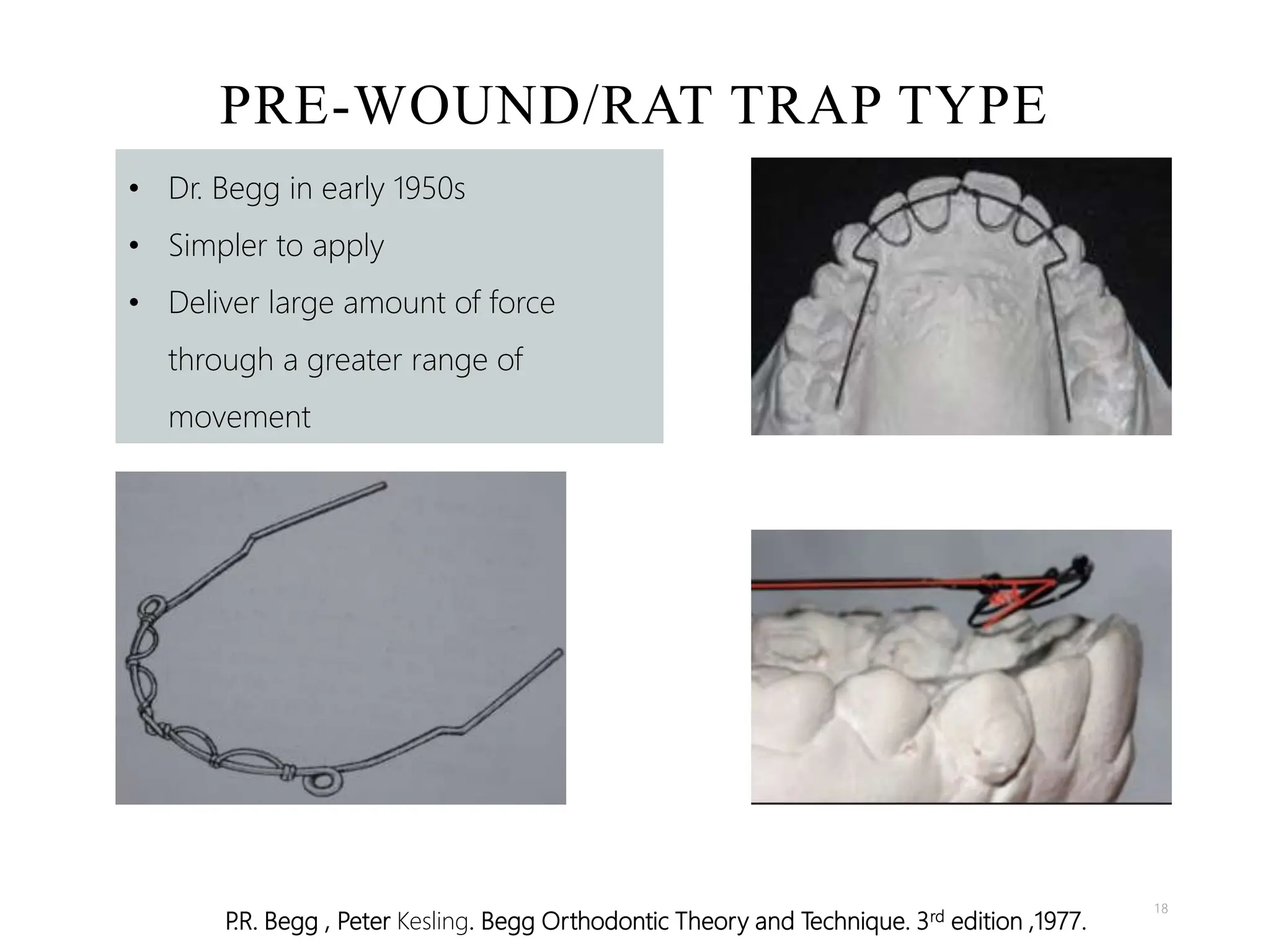 TORQUE IN ORTHODONTICS (short PPT) basic | PPTX