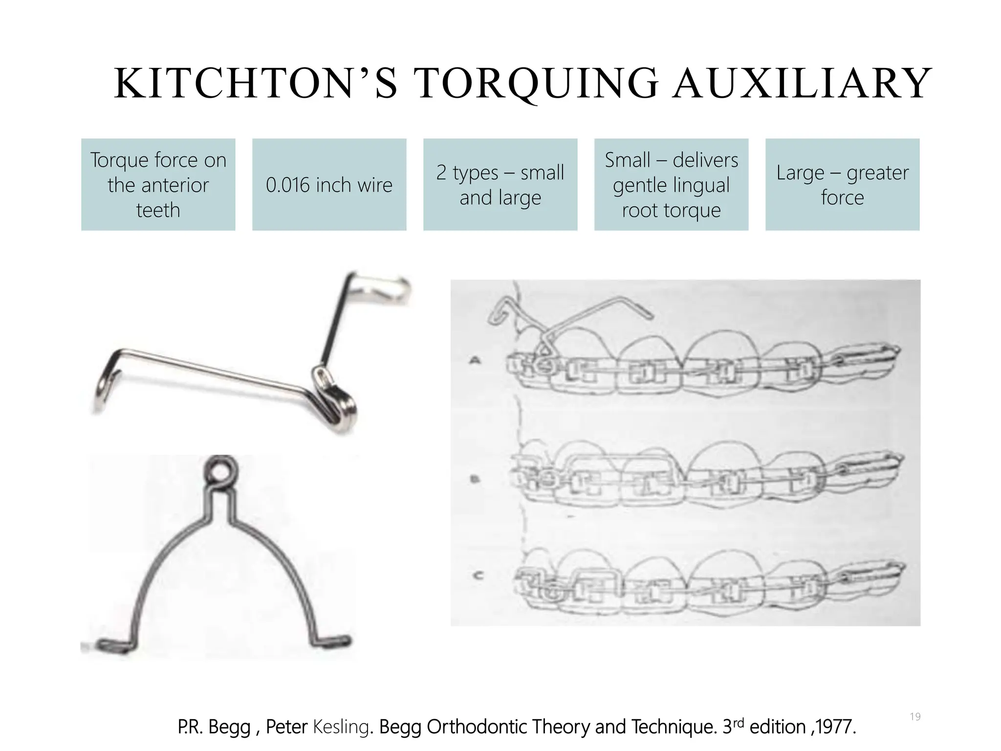 TORQUE IN ORTHODONTICS (short PPT) basic | PPTX