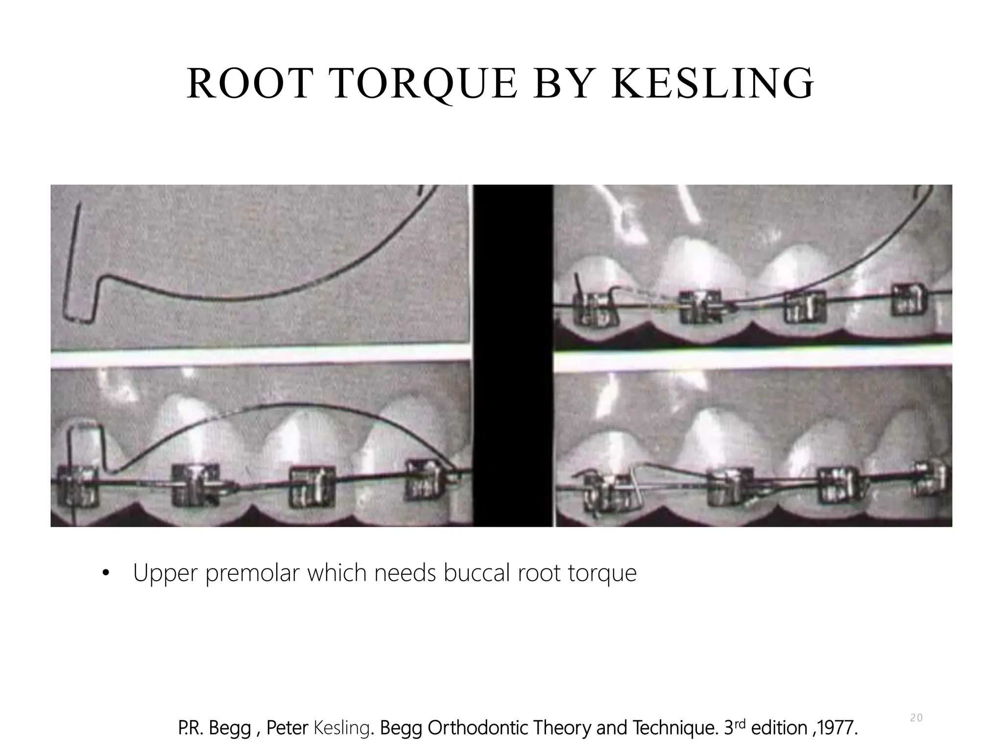 TORQUE IN ORTHODONTICS (short PPT) basic | PPTX