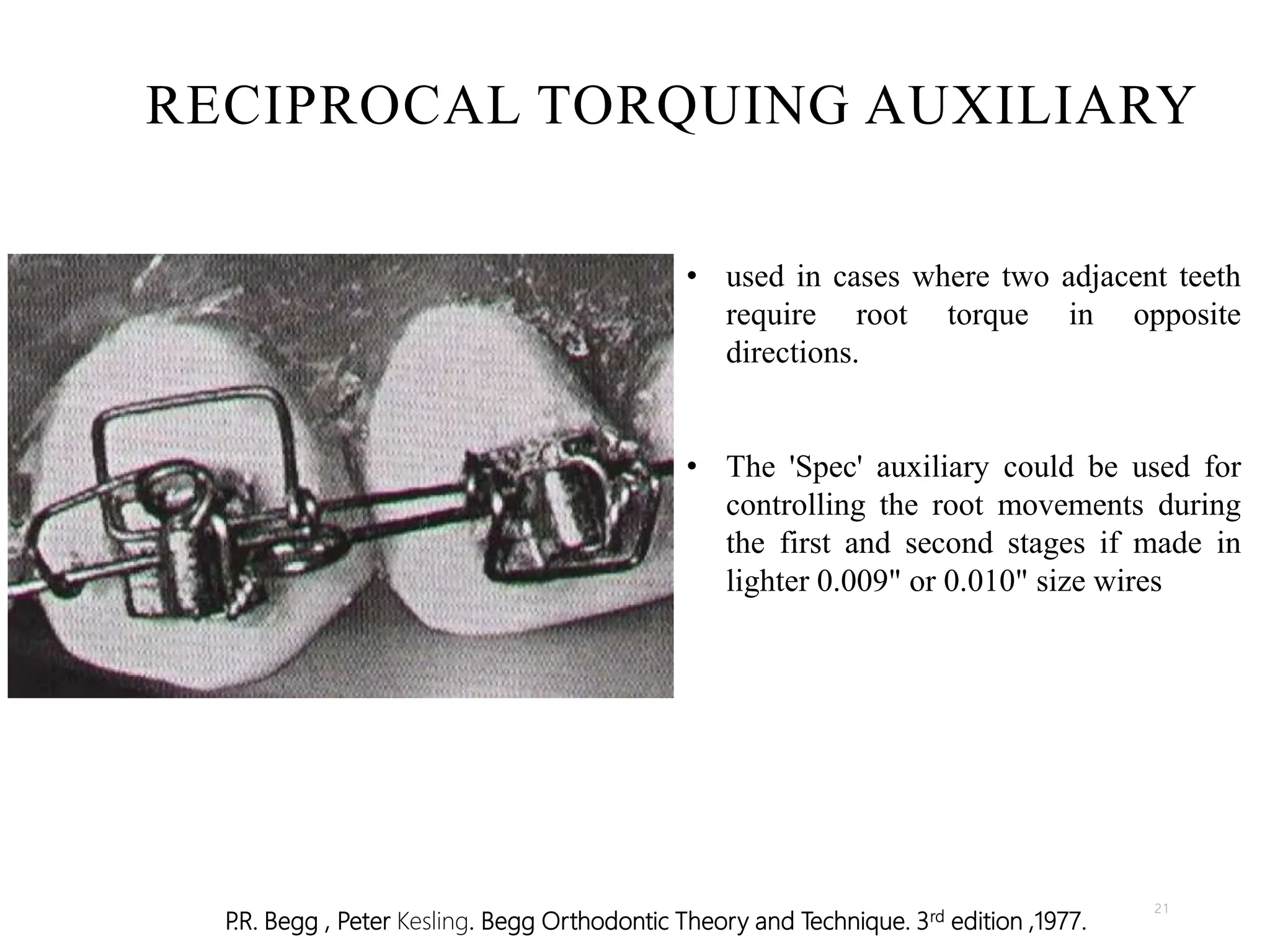 TORQUE IN ORTHODONTICS (short PPT) basic | PPTX