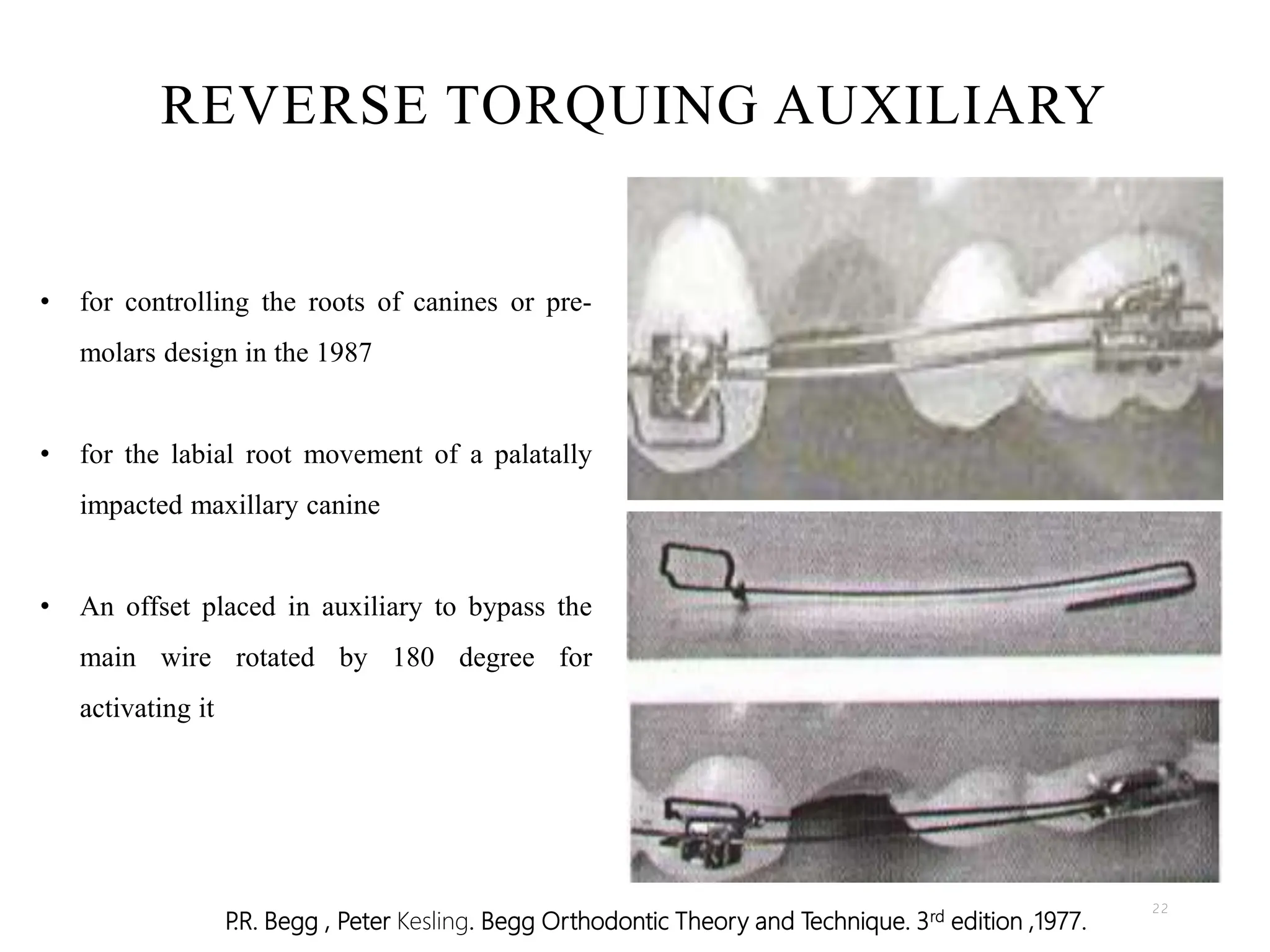 TORQUE IN ORTHODONTICS (short PPT) basic | PPTX