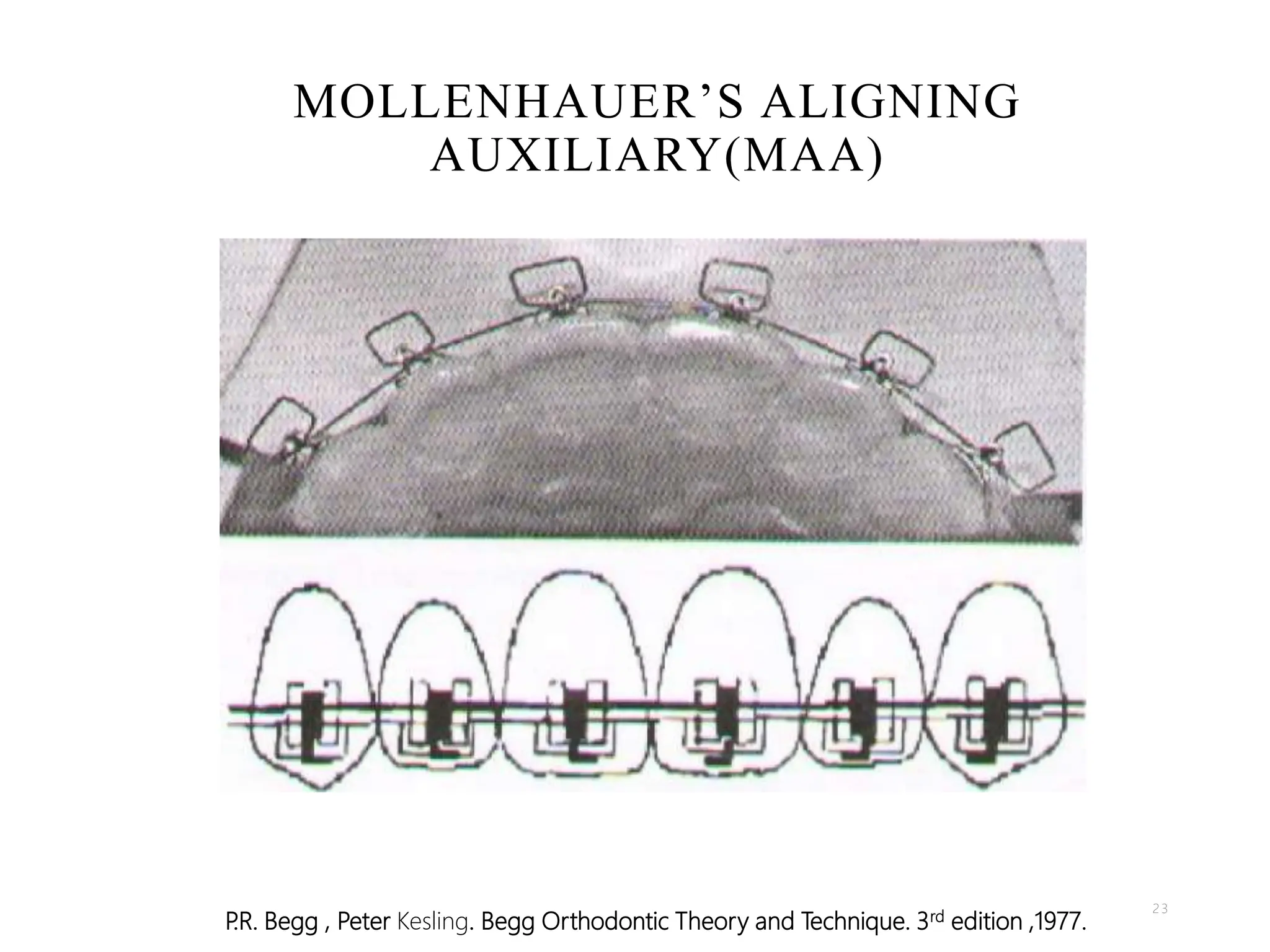 TORQUE IN ORTHODONTICS (short PPT) basic | PPTX