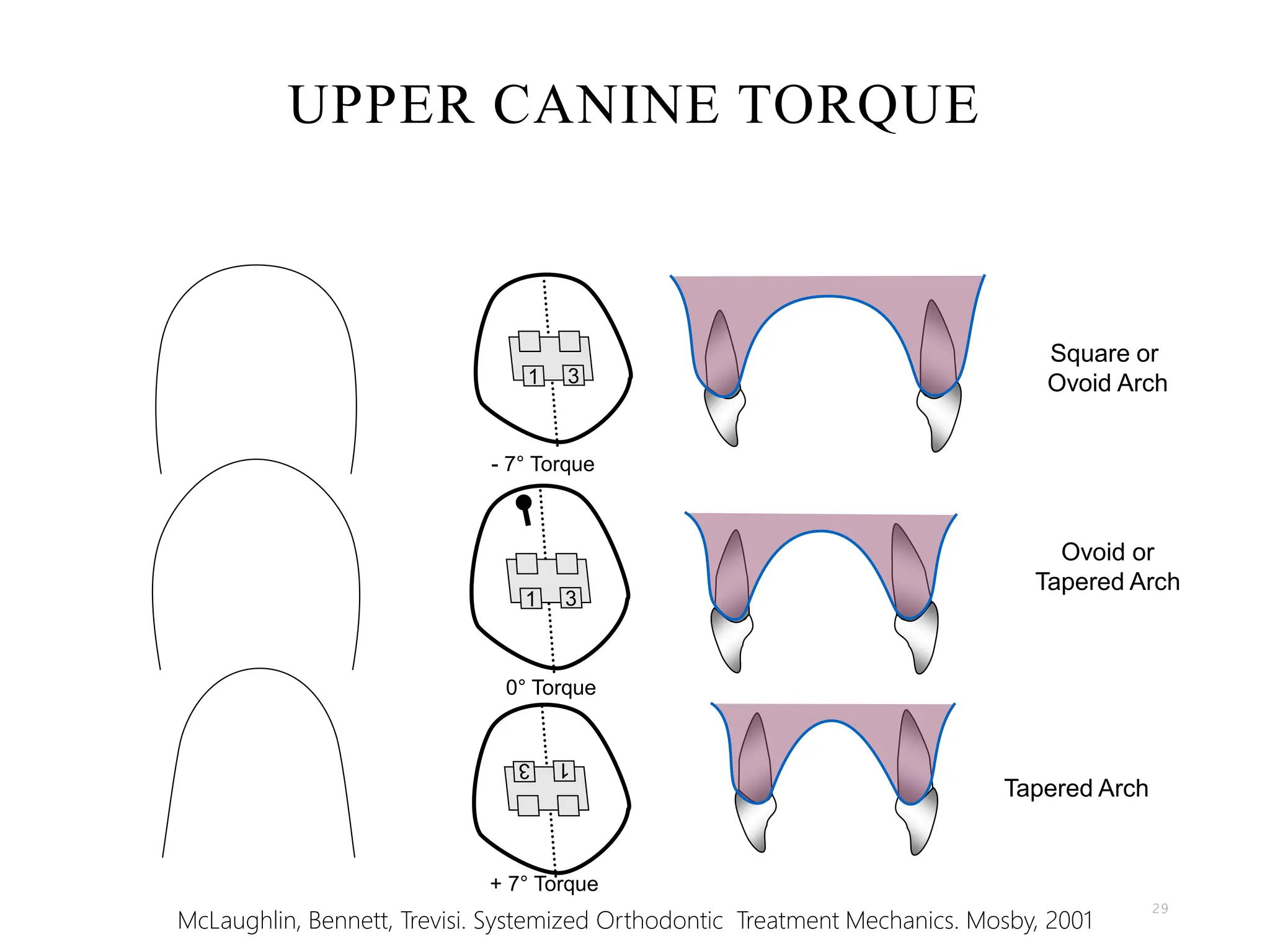 TORQUE IN ORTHODONTICS (short PPT) basic | PPTX
