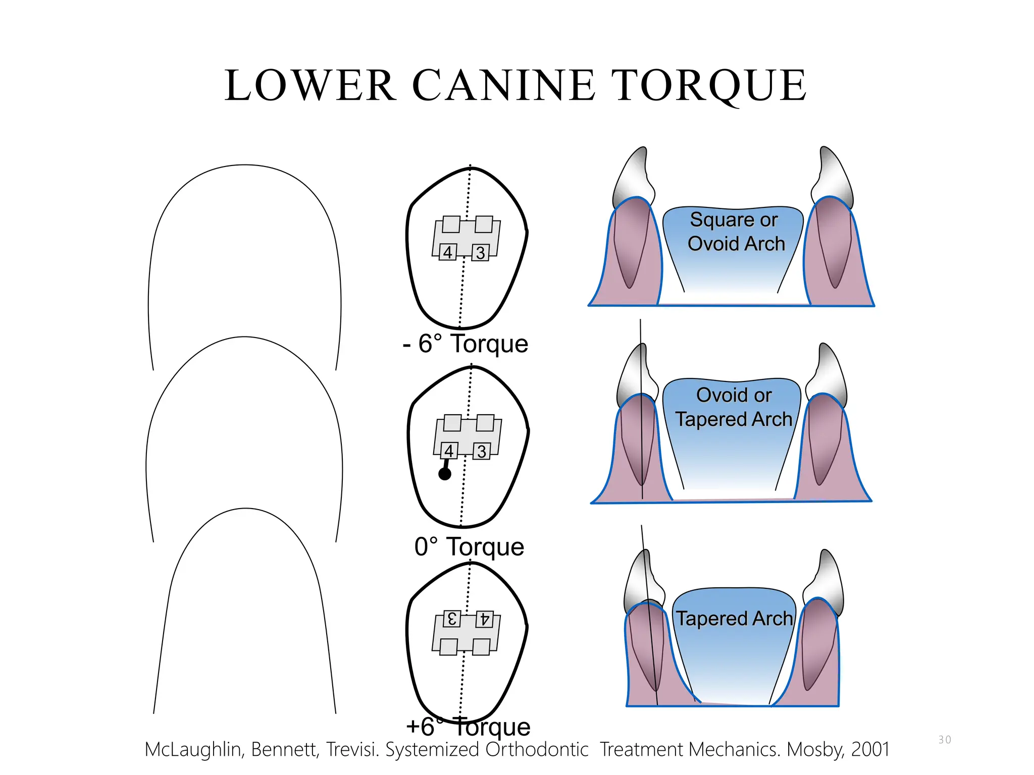 TORQUE IN ORTHODONTICS (short PPT) basic | PPTX