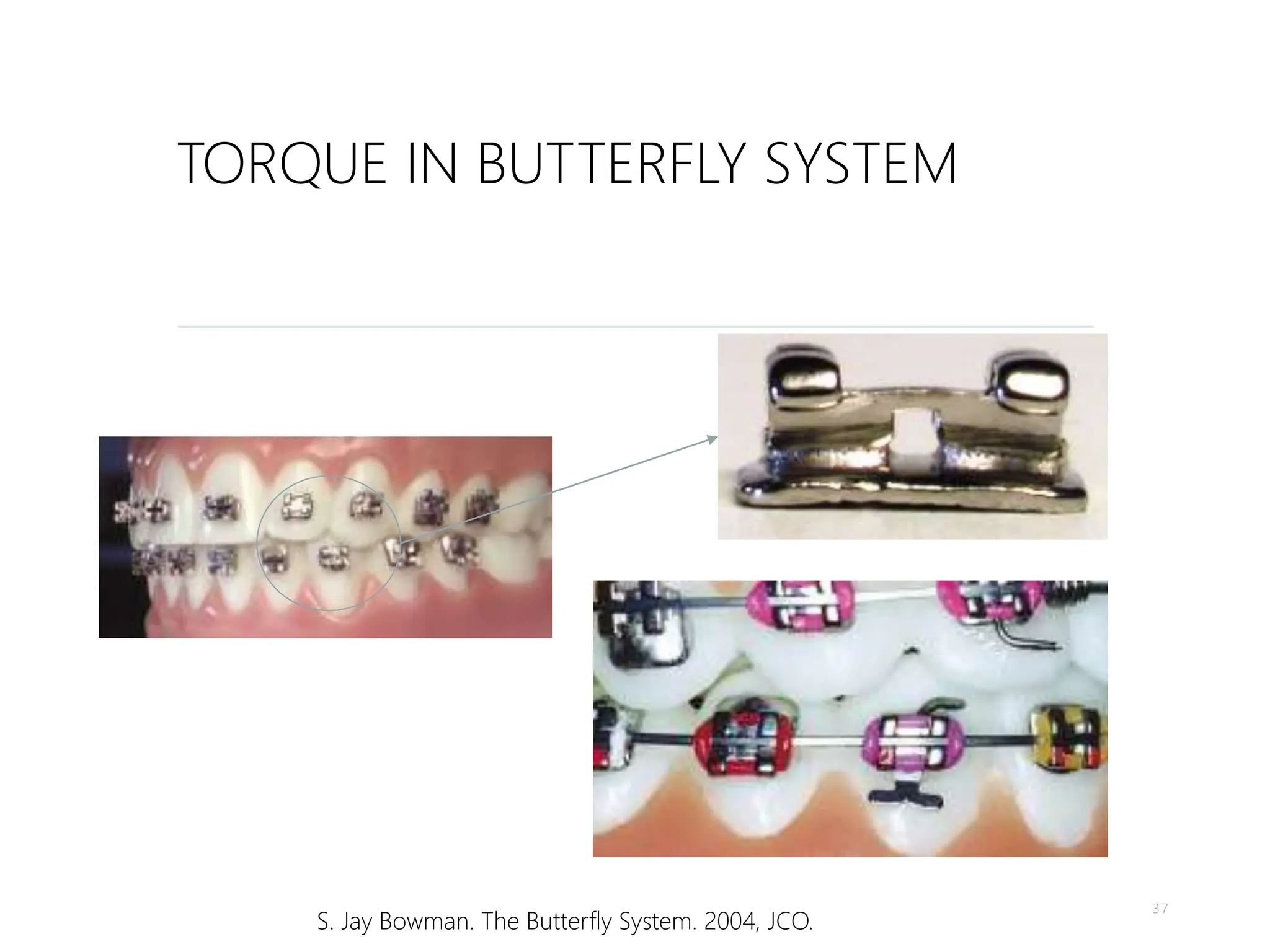 TORQUE IN ORTHODONTICS (short PPT) basic | PPTX