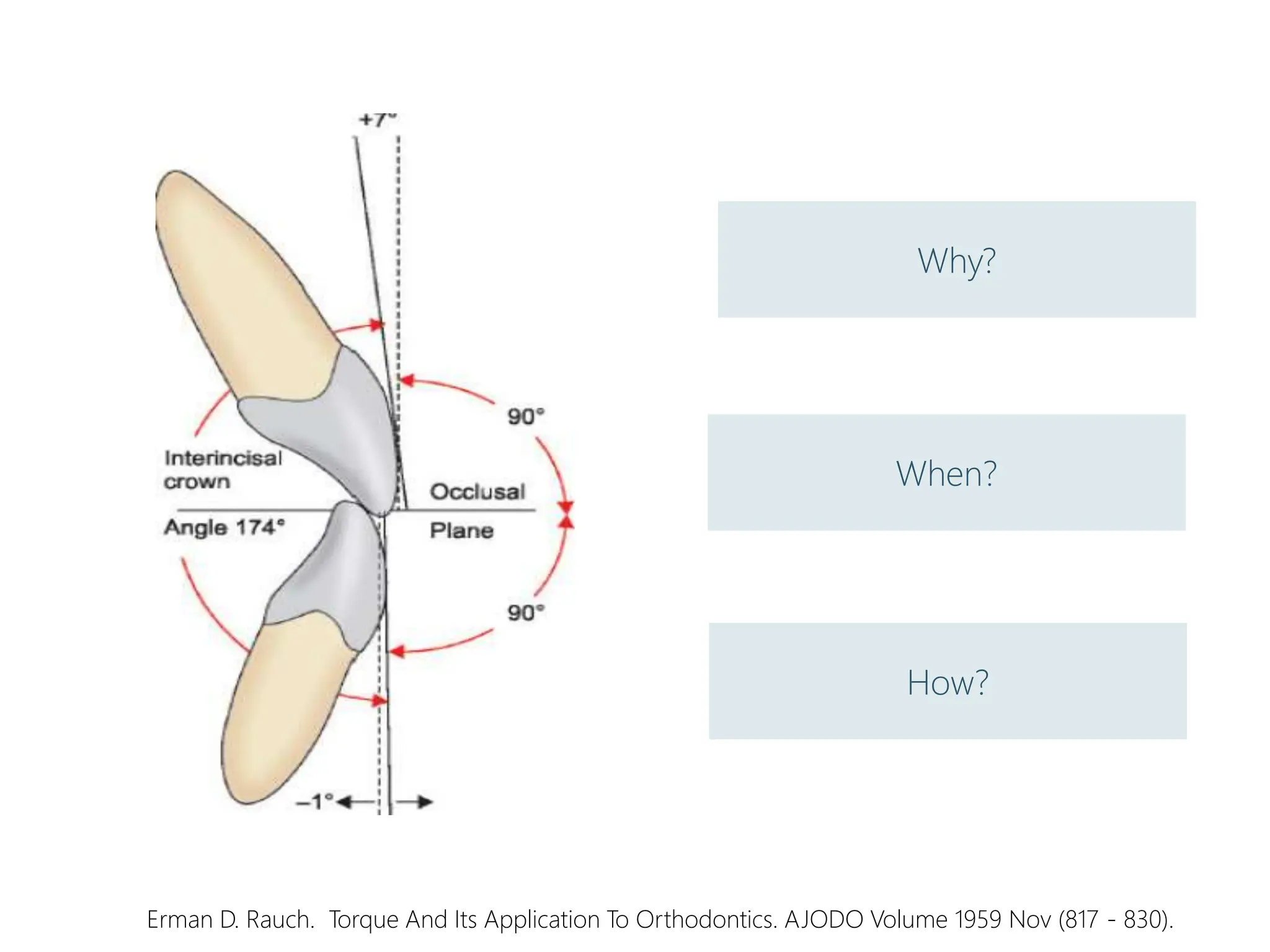 TORQUE IN ORTHODONTICS (short PPT) basic | PPTX