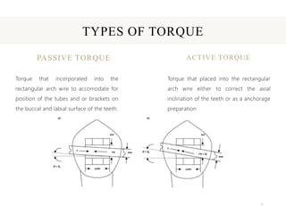 TORQUE IN ORTHODONTICS (short PPT) basic | PPTX