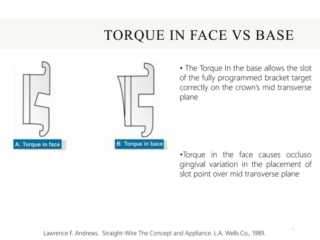 TORQUE IN ORTHODONTICS (short PPT) basic | PPTX