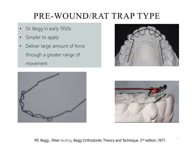 TORQUE IN ORTHODONTICS (short PPT) basic | PPTX