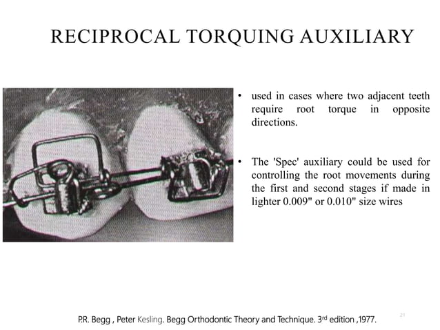 TORQUE IN ORTHODONTICS (short PPT) basic | PPTX