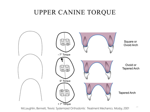 TORQUE IN ORTHODONTICS (short PPT) basic | PPTX