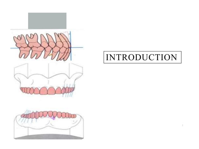TORQUE IN ORTHODONTICS (short PPT) basic | PPTX