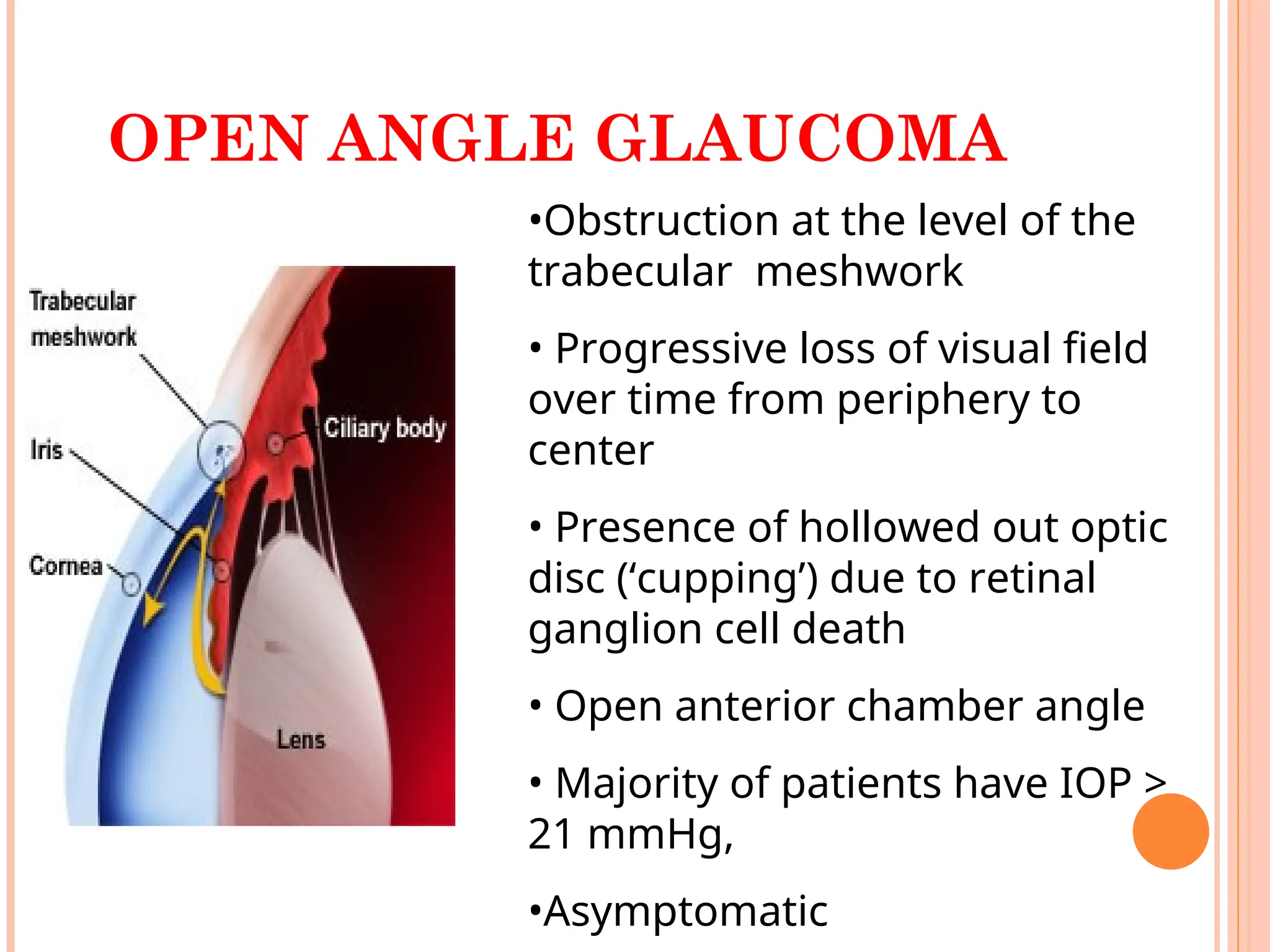 Chapter 1. GLAUCOMA lecture three3 .ppt