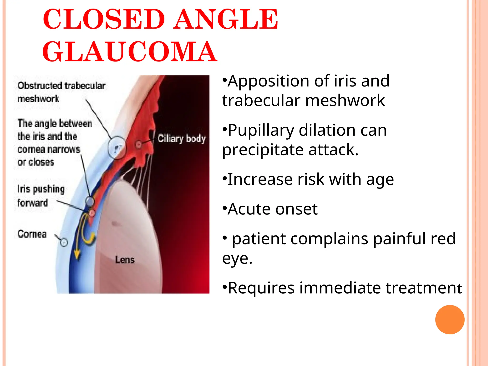 Chapter 1. GLAUCOMA lecture three3 .ppt