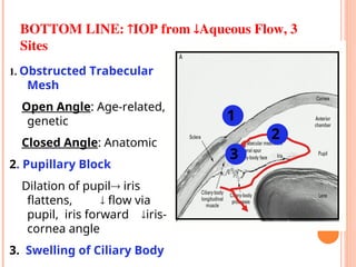 Chapter 1. GLAUCOMA lecture three3 .ppt