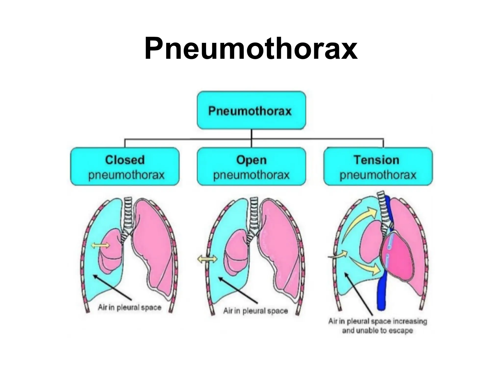 8. Respiratory System anatomy and physiology.pptx