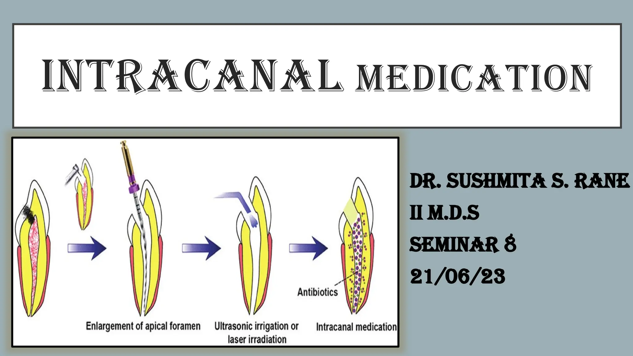 INTRACANAL MEDICAMENT IN ENDODONTICS. pptx | PPTX