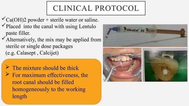 INTRACANAL MEDICAMENT IN ENDODONTICS. pptx | PPTX