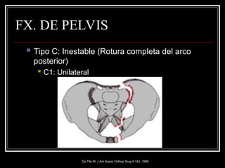 Fractura de Pelvis Traumatología y Ortopedia | PPT