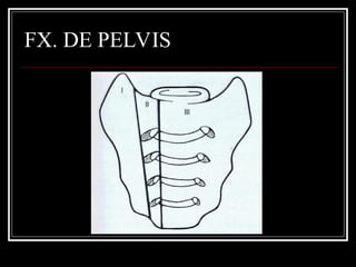 Fractura de Pelvis Traumatología y Ortopedia | PPT