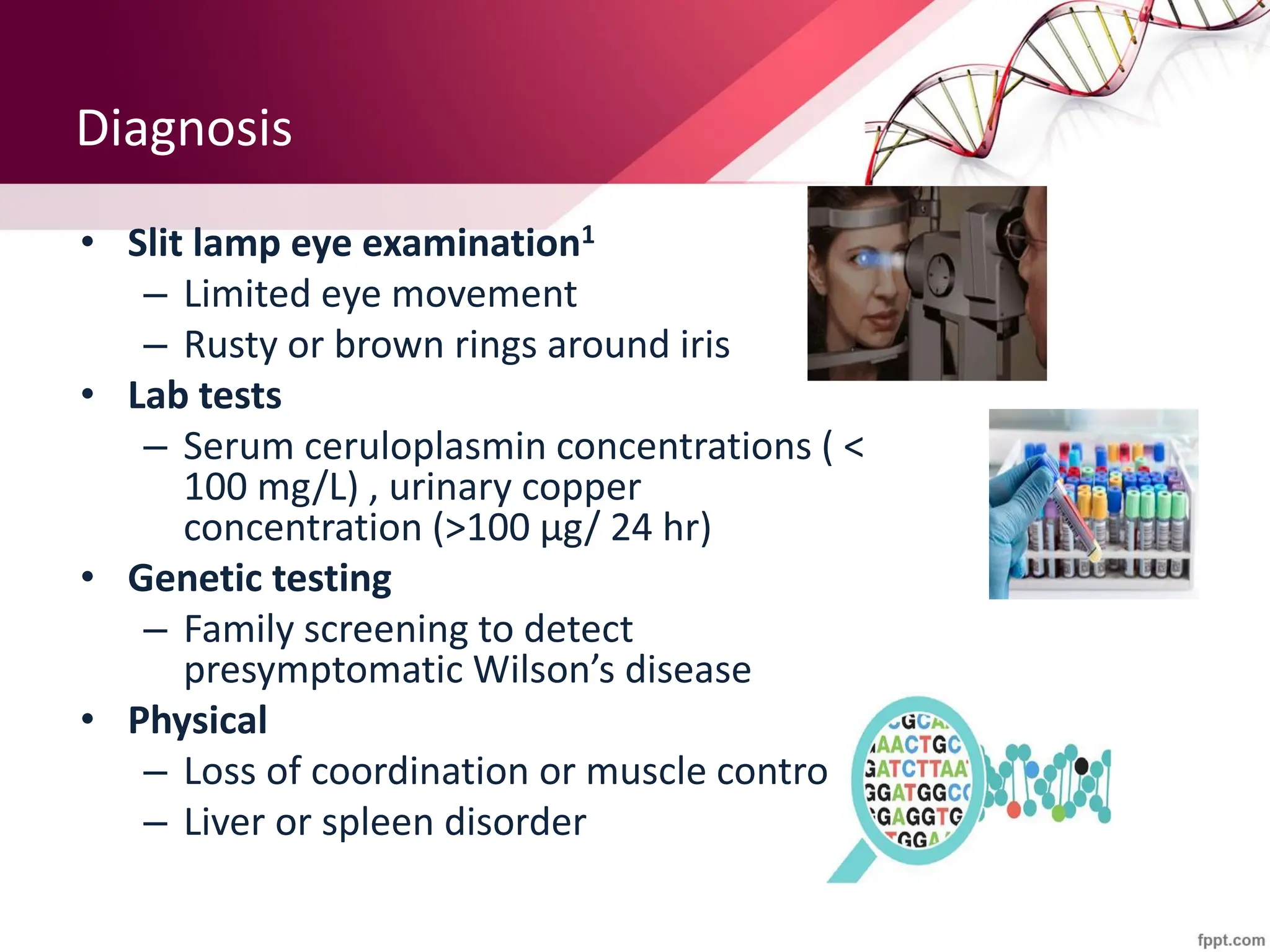 Wilson Disease - pathology, signs and symptoms | PPT