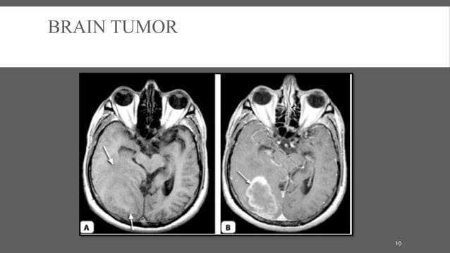 8.CLINICAL APPLICATION OF MRI.pptx by ravindra kumar.pptx