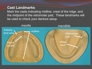 Setting anterior teeth complete denture | PPTX