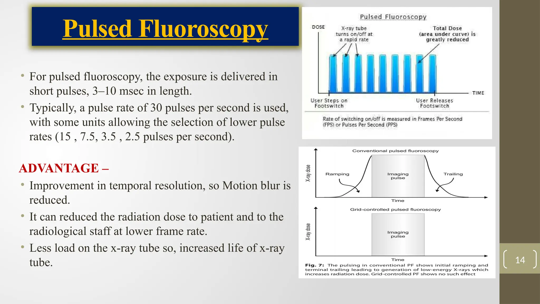 8. IITV , Digital Fluoroscopy and DSA by Ravindra Kumar.pptx