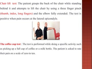 8.Elbow Epicondylitis 2025(3).pdf