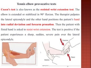 8.Elbow Epicondylitis 2025(3).pdf