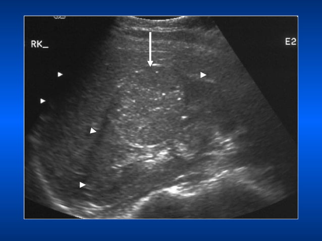 8. ULTRASOUND TERMINOLOGIES IN ULTRASONOGRAPHY.ppt