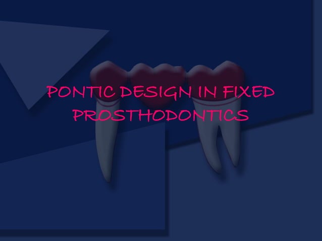 8. PONTIC DESIGN IN FIXED PROSTHODONTICS.pptx