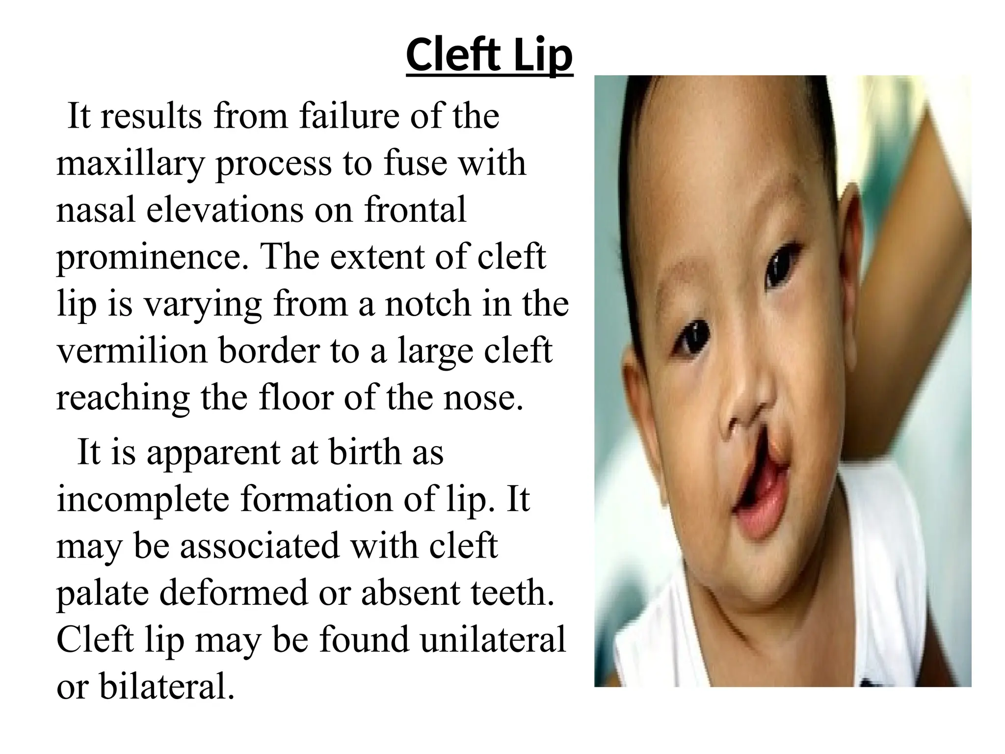 Gastro intestinal disorders in children ppt | PPTX