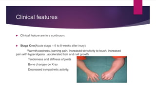 sudecks osteodystrophy | PPTX