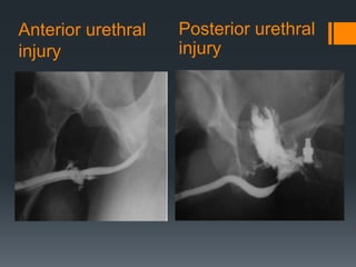 8 - Abdominal trauma 2 | PPTX