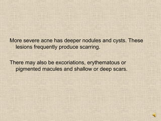 8. acne and rosacea | PPT