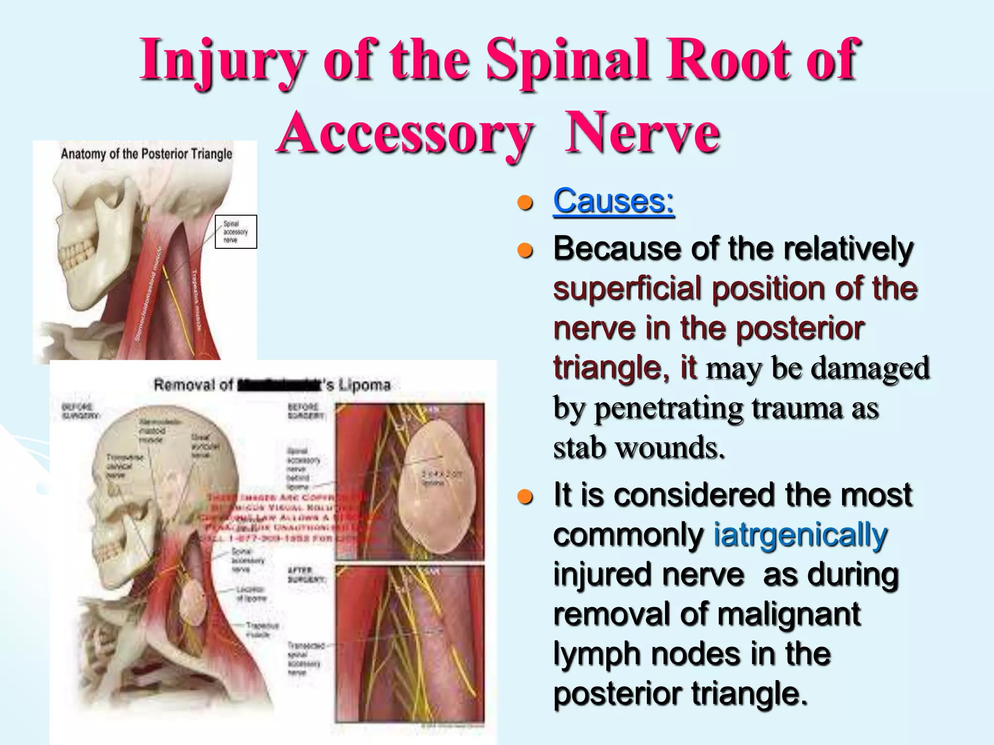 Anatomy of CN XI & XII | PPT