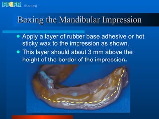 8.boxing impressions and making casts | PPT
