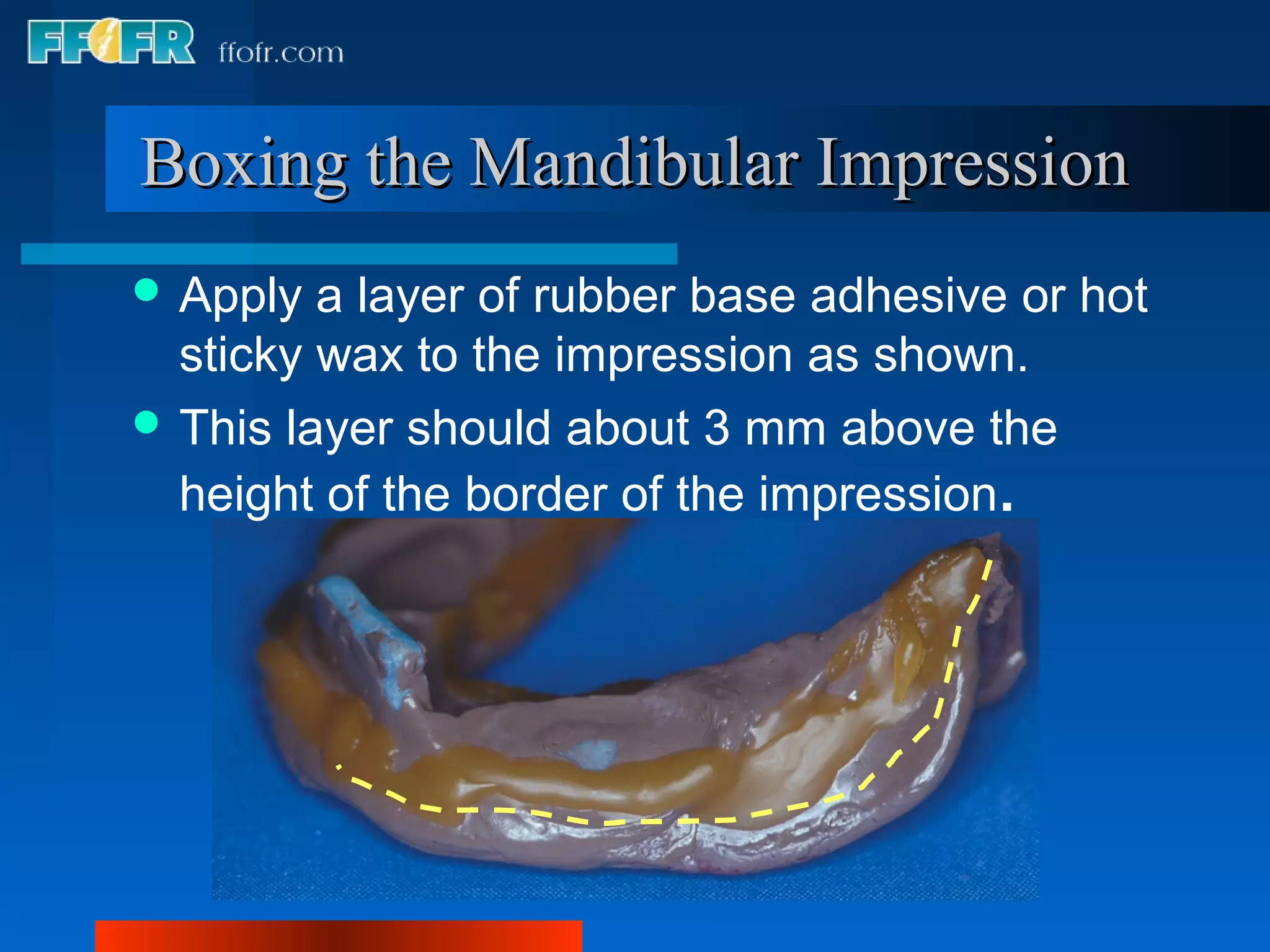 8.boxing impressions and making casts | PPT