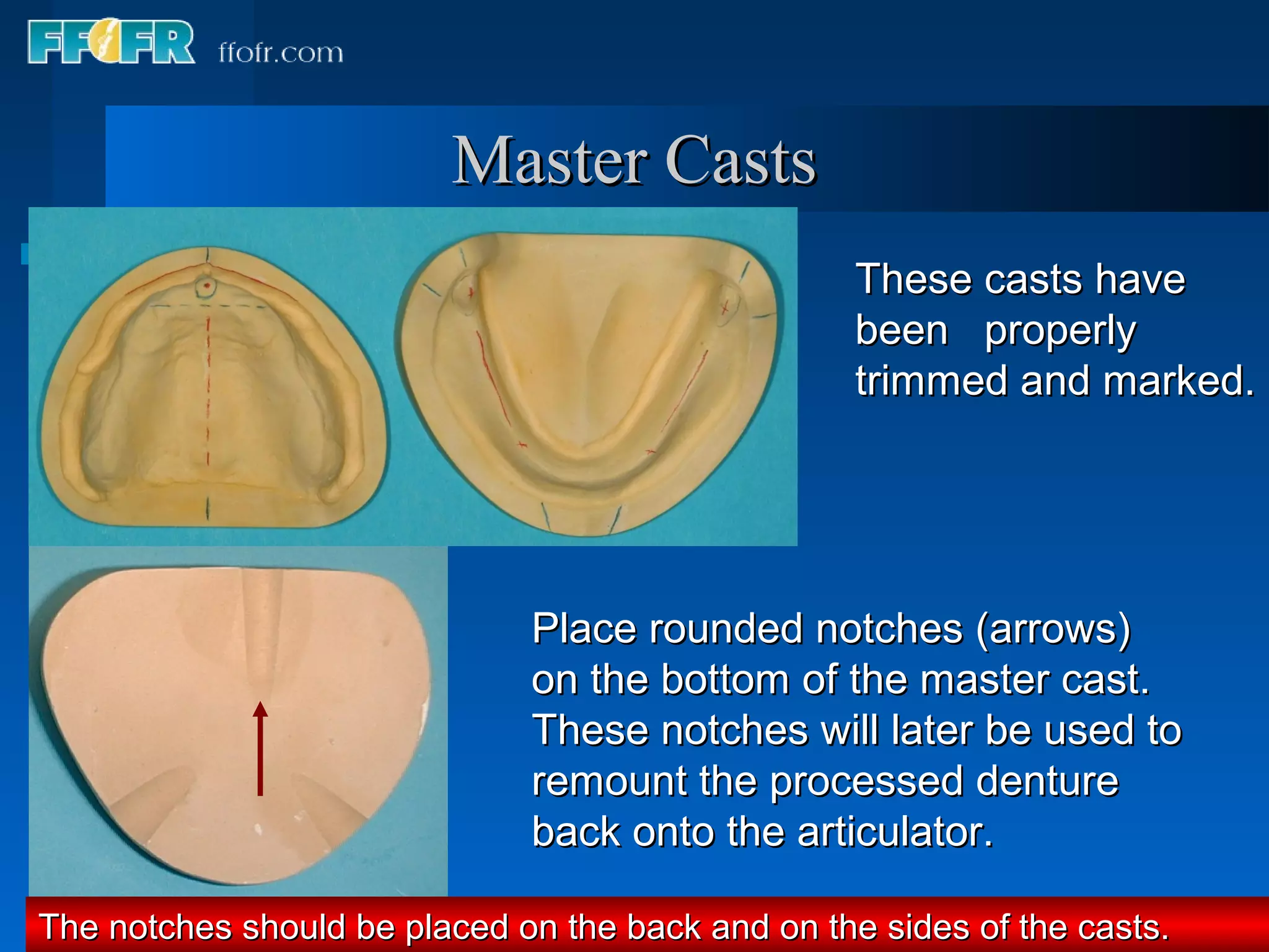 8.boxing impressions and making casts | PPT