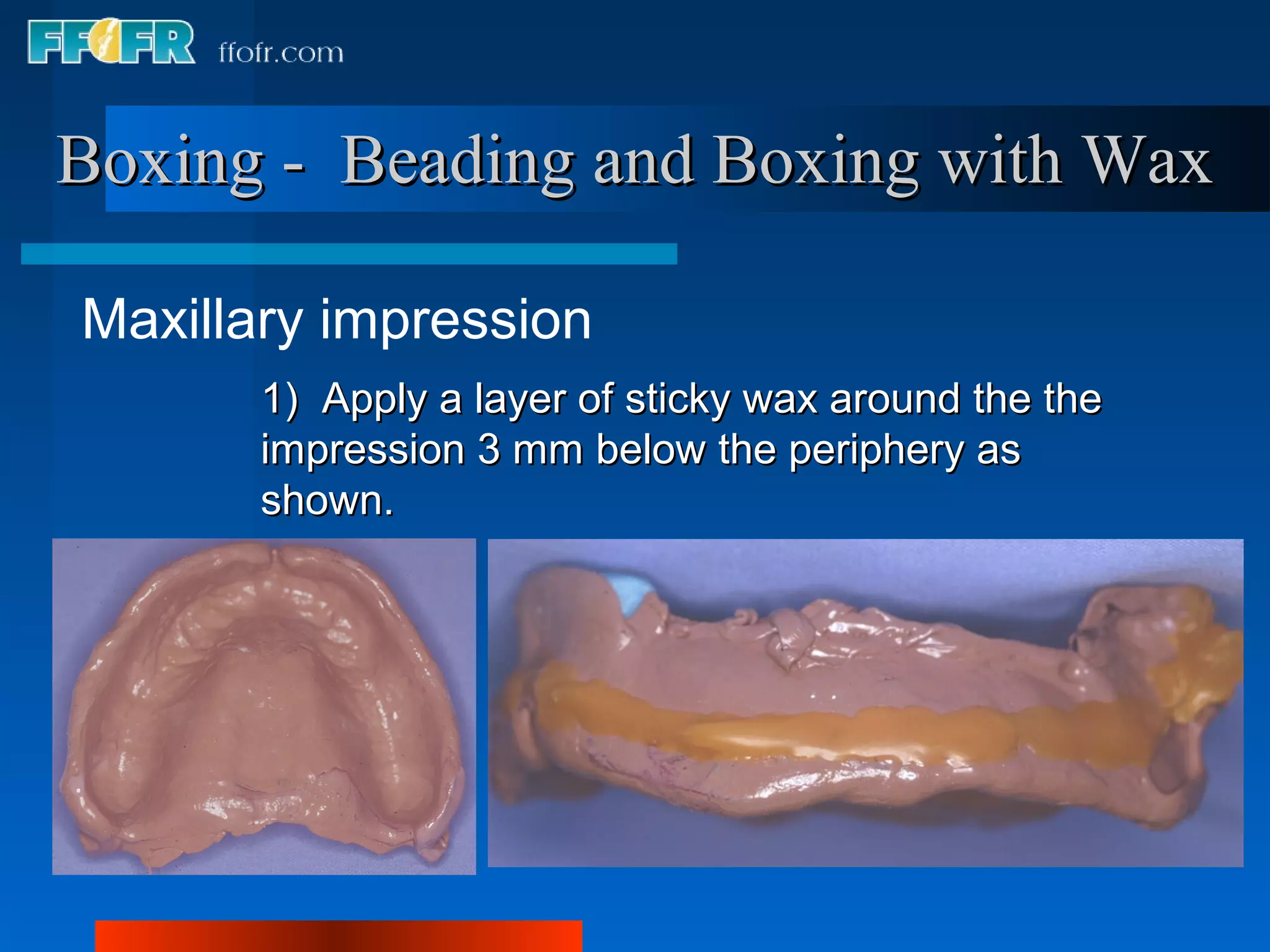 8.boxing impressions and making casts | PPT