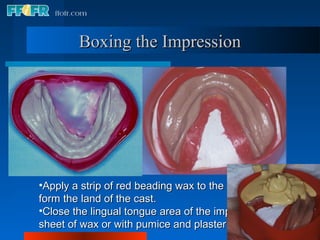 8.boxing impressions and making casts | PPT