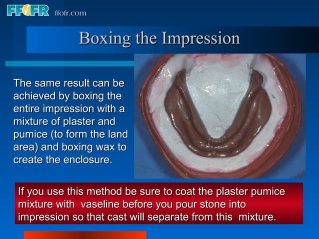 8.boxing impressions and making casts | PPT | Oral care | Personal Care