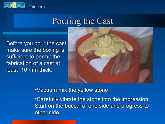 8.boxing impressions and making casts | PPT | Oral care | Personal Care