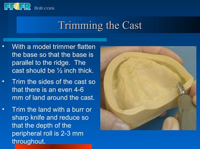 8.boxing impressions and making casts | PPT | Oral care | Personal Care
