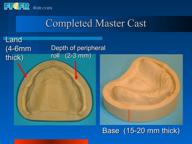 8.boxing impressions and making casts | PPT | Oral care | Personal Care