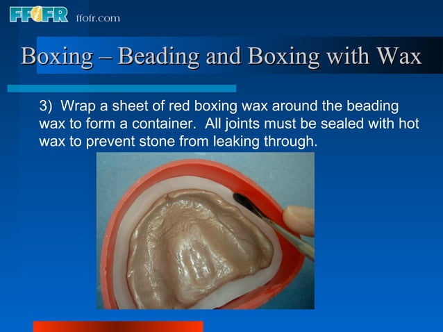 8.boxing impressions and making casts | PPT | Oral care | Personal Care