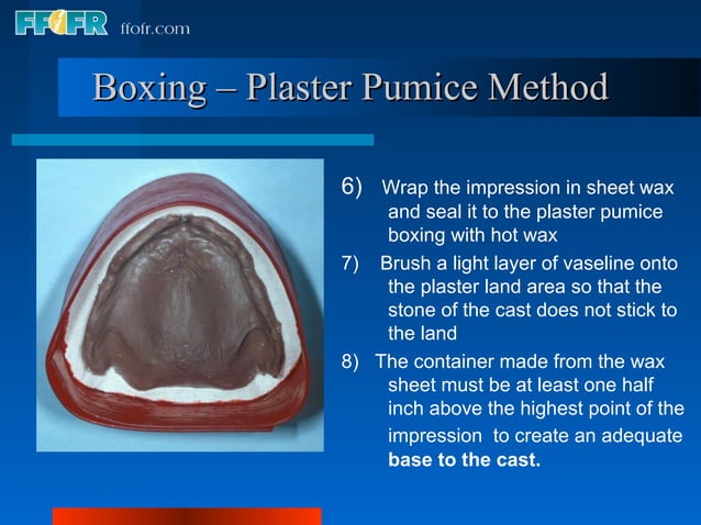 8.boxing impressions and making casts | PPT | Oral care | Personal Care