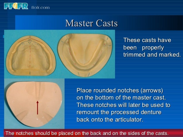 8.boxing impressions and making casts